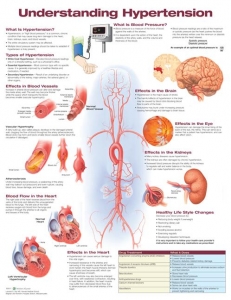 Understanding Hypertension Anatomical Chart | Medline Industries, Inc.