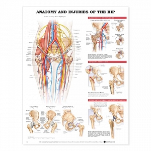Anatomy and Injuries of the Hip Chart | Medline Industries, Inc.