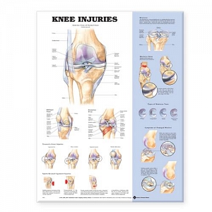 Knee Injuries Anatomical Chart by Wolters Kluwer | Medline Industries, Inc.