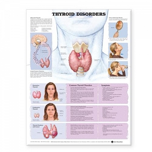 Thyroid Disorders Anatomical Chart | Medline Industries, Inc.