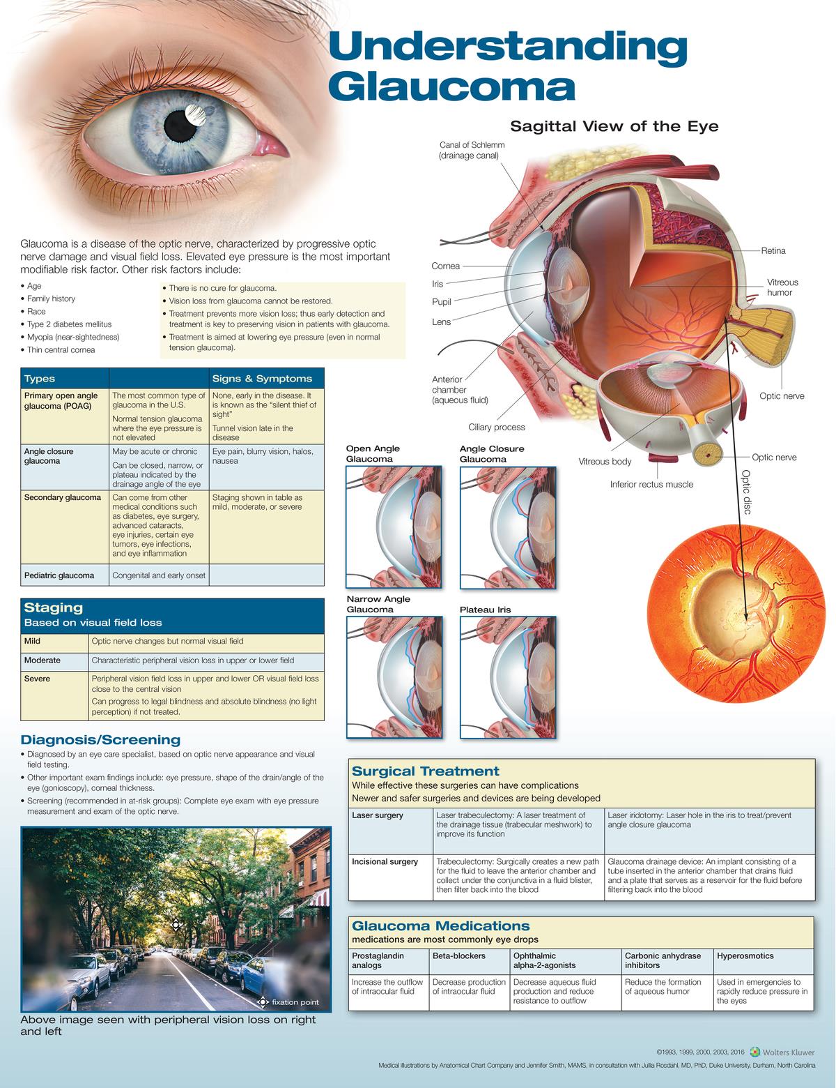 Understanding Glaucoma Anatomical Chart | Medline