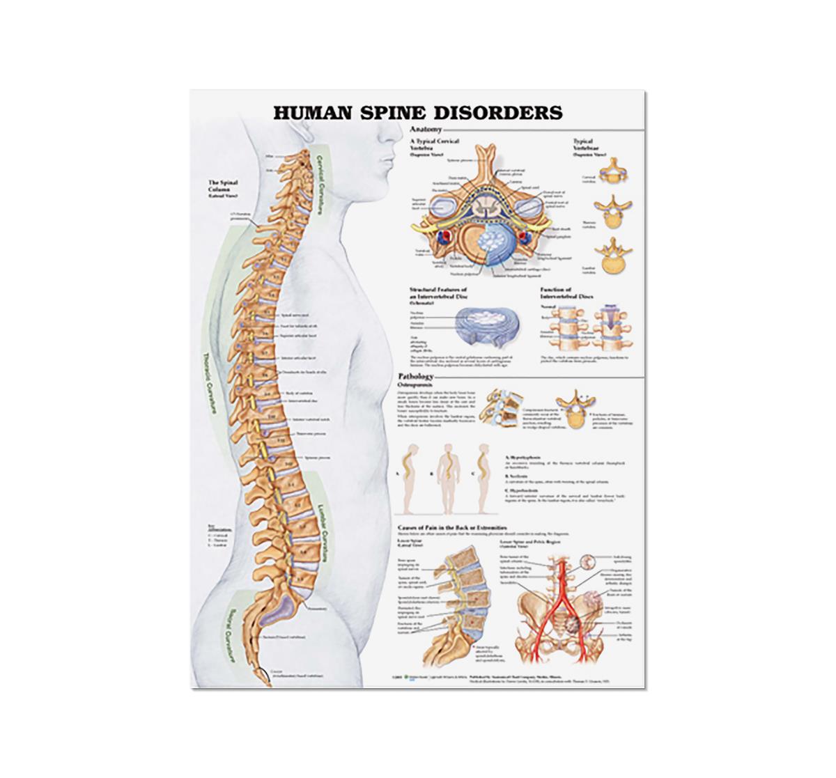 Human Spine Disorders Anatomical Chart | Medline