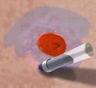 Marathon® Liquid Skin Protectant | Medline Industries, Inc.