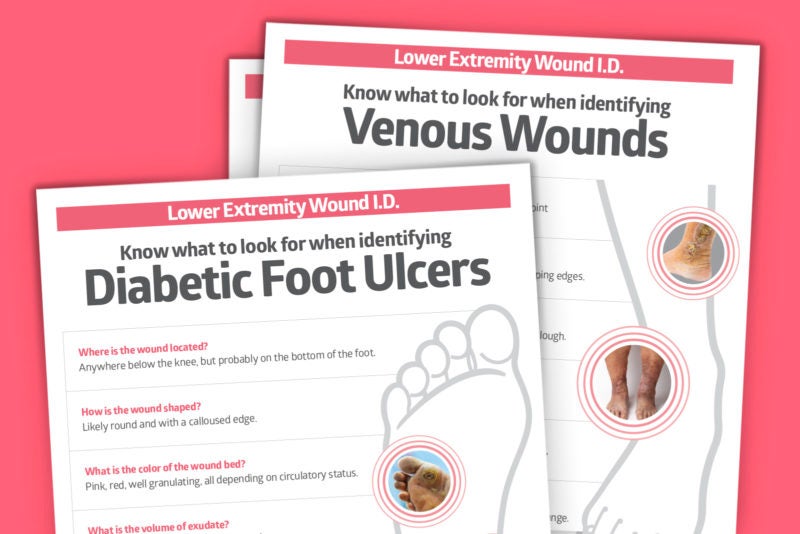 Skin Health: Lower Extremity Poster Download - Medline