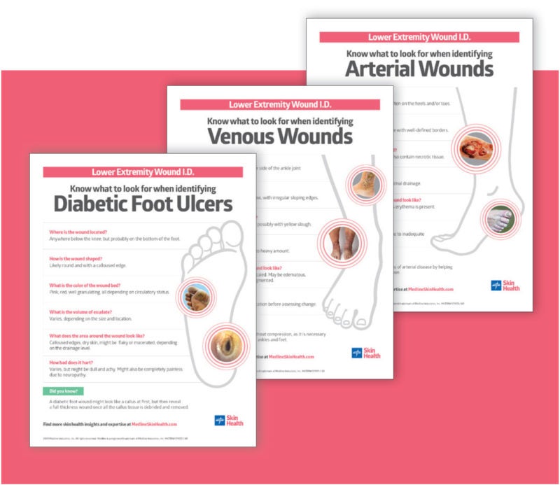 Skin Health Solution: Wound Poster Download - Medline