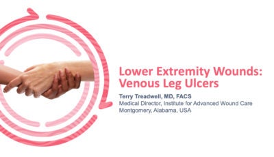 Webinar - Lower Extremity Wounds: Venous Leg Ulcers - Medline
