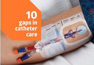 Infection Prevention