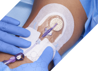 SorbaView Shield - Medline