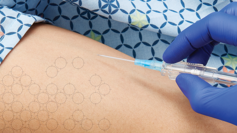 Target CABSI risk: Check your patient’s peripheral IV line