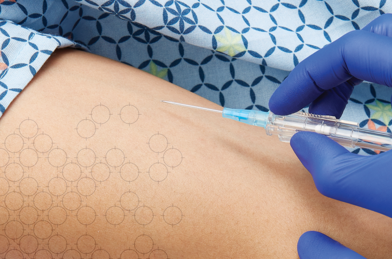 INS standards of practice: Don’t overlook peripheral IVs as a source of ...