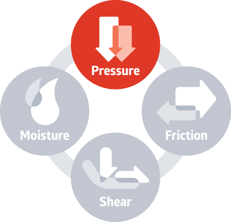 Fight the 4 risk factors for pressure injuries