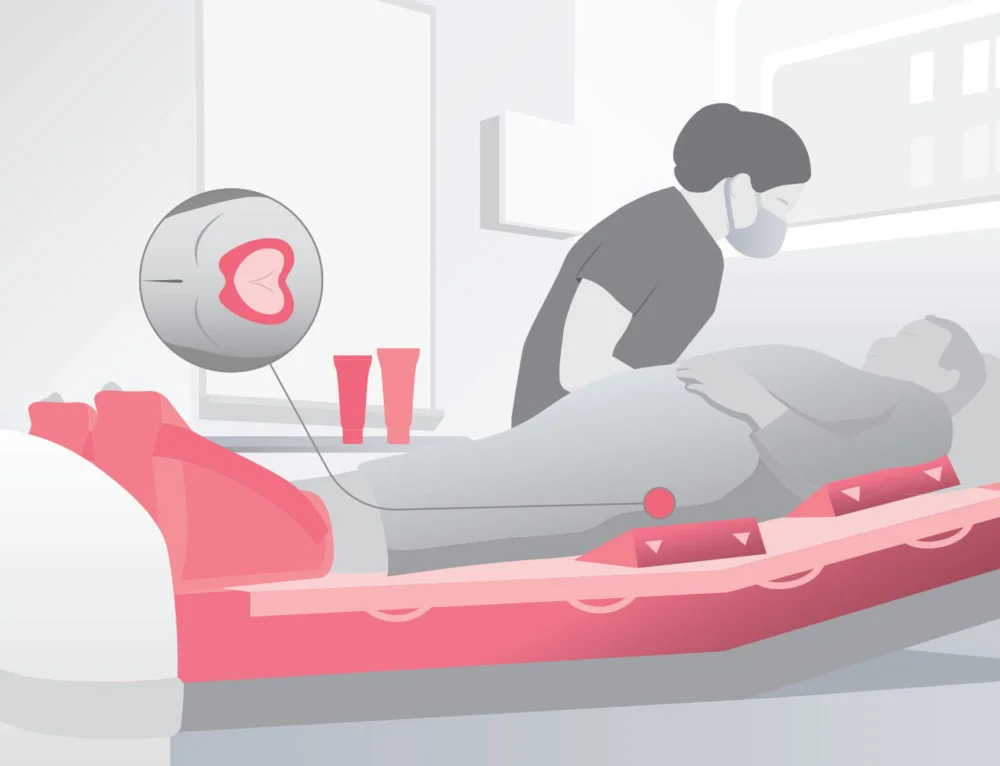 How do you distinguish a venous ulcer from an arterial wound? Here’s ...