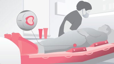 Prevent pressure injuries: Know the 4 contributing factors - Medline