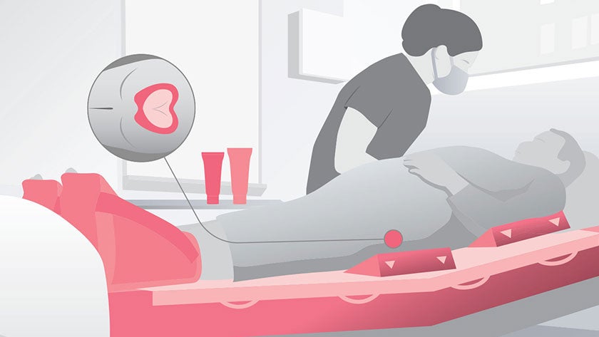 Prevent pressure injuries: Know the 4 contributing factors - Medline