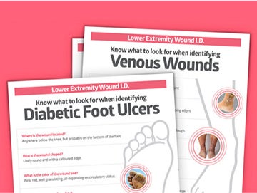 Venous leg ulcers: Overcome barriers to healing
