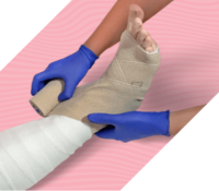Venous stasis- Medline