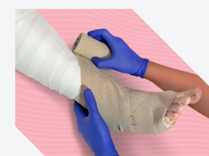 Venous leg ulcers: Overcome barriers to healing