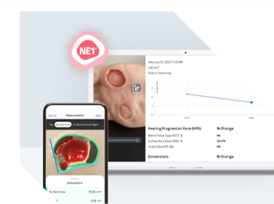 Digital wound care beyond measure - Medline