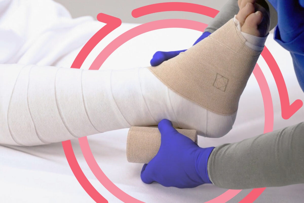 Treating venous leg ulcers? Compression has come a long way since the ...
