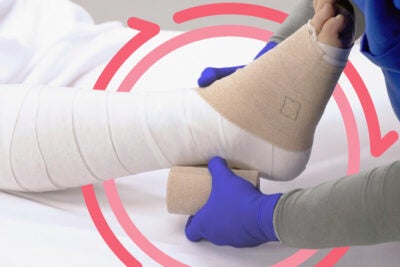 Treating venous leg ulcers? Compression has come a long way since the ...