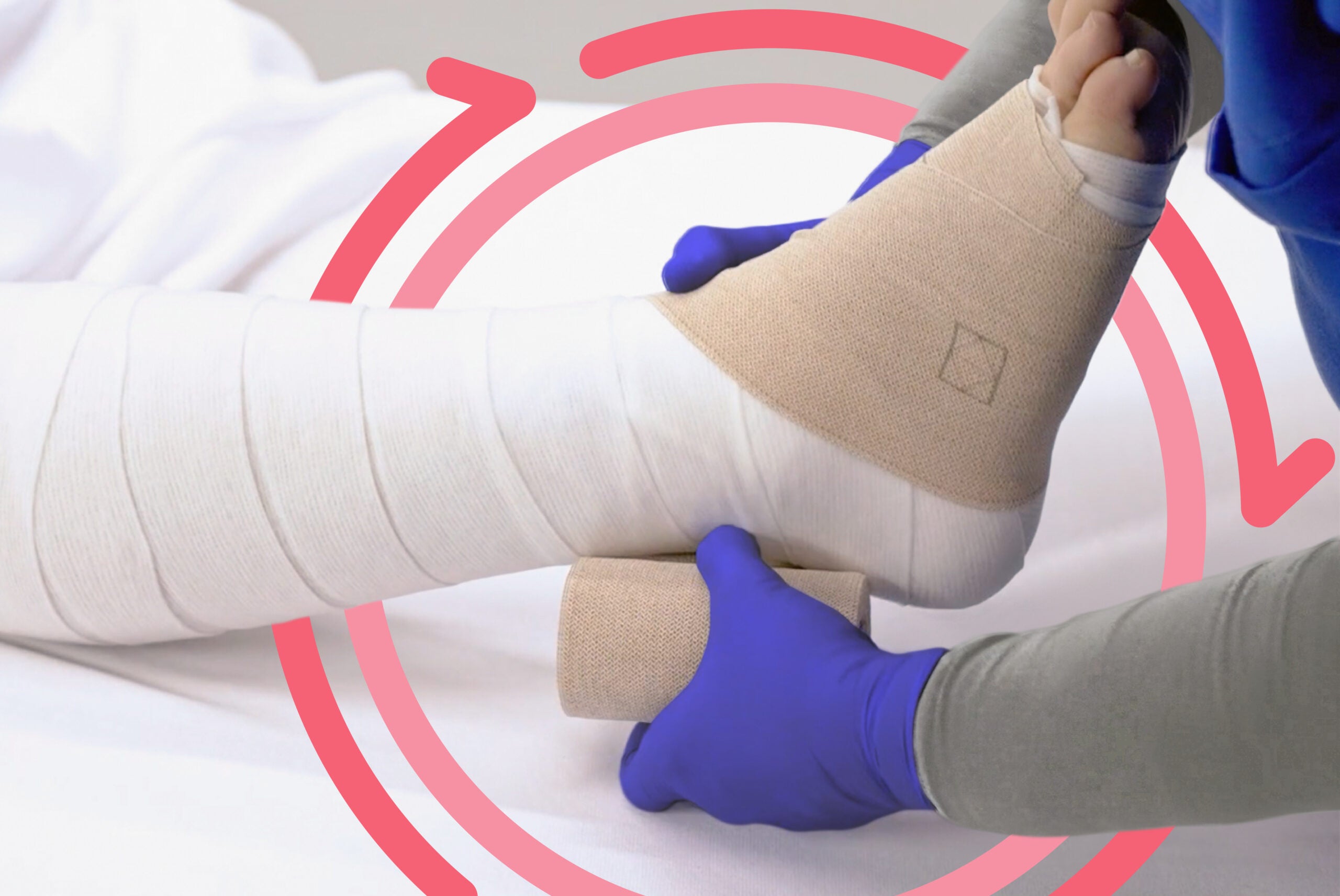 Treating venous leg ulcers? Compression has come a long way since the ...