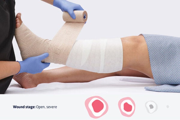 Accuwrap Comprecares - Medline