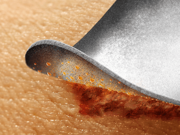 Fight biofilm formation and heal wounds faster