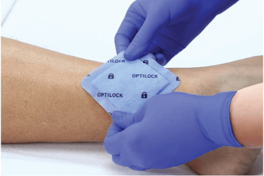 Explore products to manage exudate and moisture - Medline