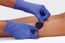 Explore products to improve the wound environment - Medline