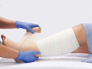 Best compression products for managing venous insufficiency - Medline