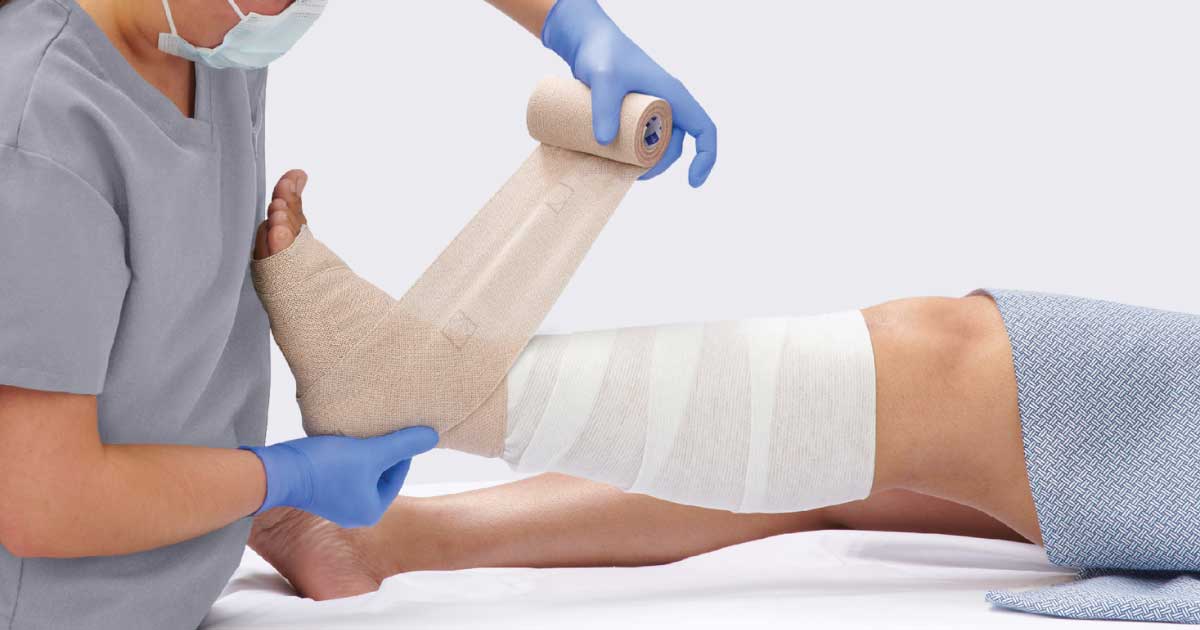 Best compression products for managing venous insufficiency - Medline