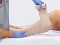 Best compression products for managing venous insufficiency - Medline