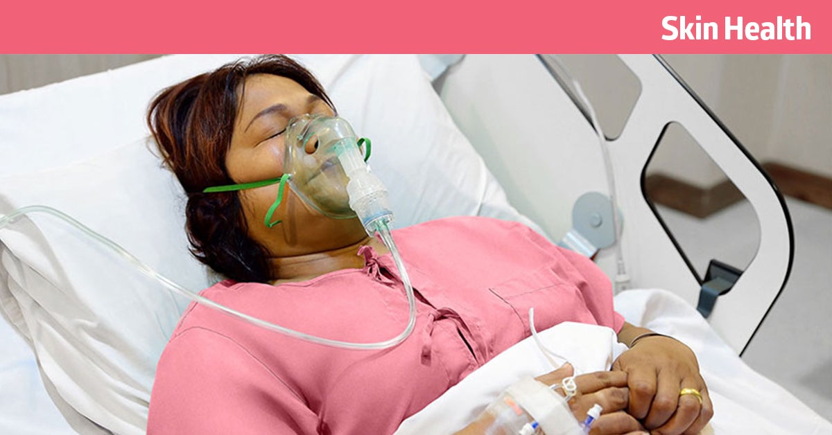 Know How To Prevent Medical Device-Related Pressure Injuries - Medline