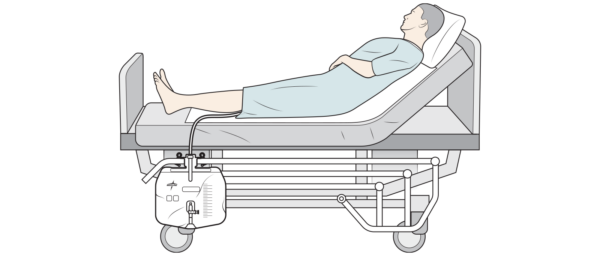 Optimizing catheter care by CNAs and other non-clinicians