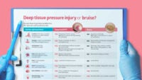 Deep tissue pressure injury vs. bruise: Know the differences