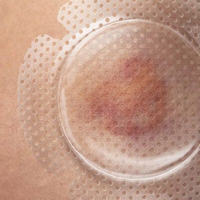The clear wound dressing that stays intact up to 4.5 times longer