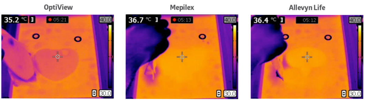 The clear wound dressing that’s the future of PI prevention