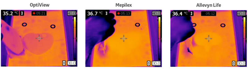 The clear wound dressing that’s the future of PI prevention