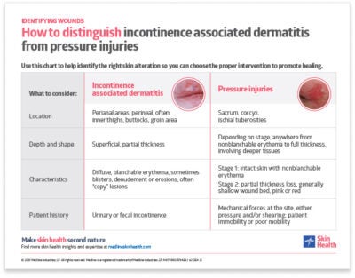 Pressure injury stages: What they are and why they matter