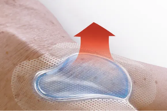OptiView® Transparent Dressing with HydroCore™ Technology
