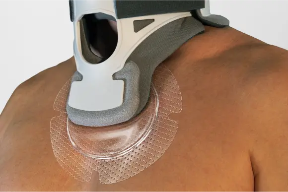 OptiView® Transparent Dressing with HydroCore™ Technology