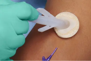 CVC Dressing Change System - Medline