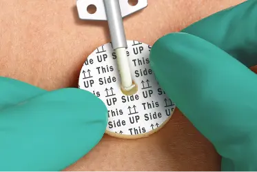 CVC Dressing Change System - Medline