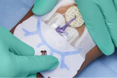 CVC Dressing Change System - Medline