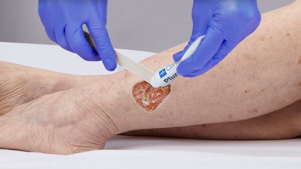Debridement: What clinicians need to know