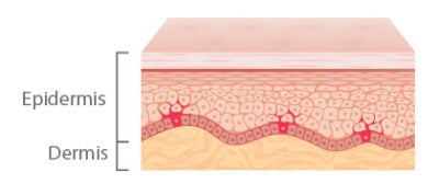 Skin integrity: What it is and how to protect every layer