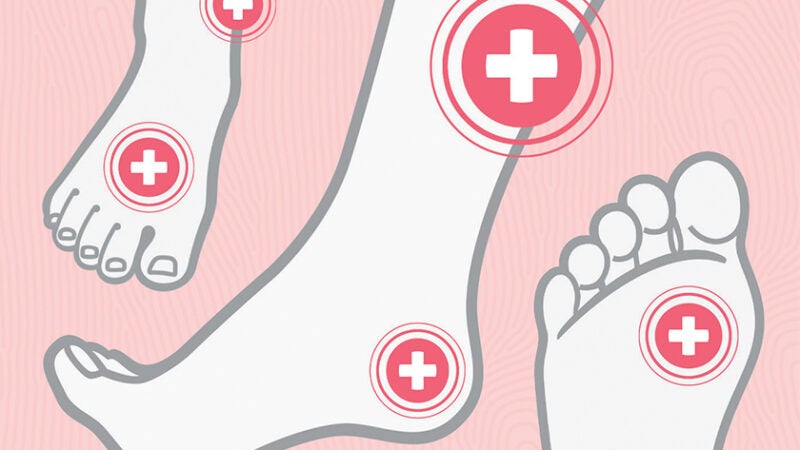 Arterial vs venous ulcers: What's the difference?