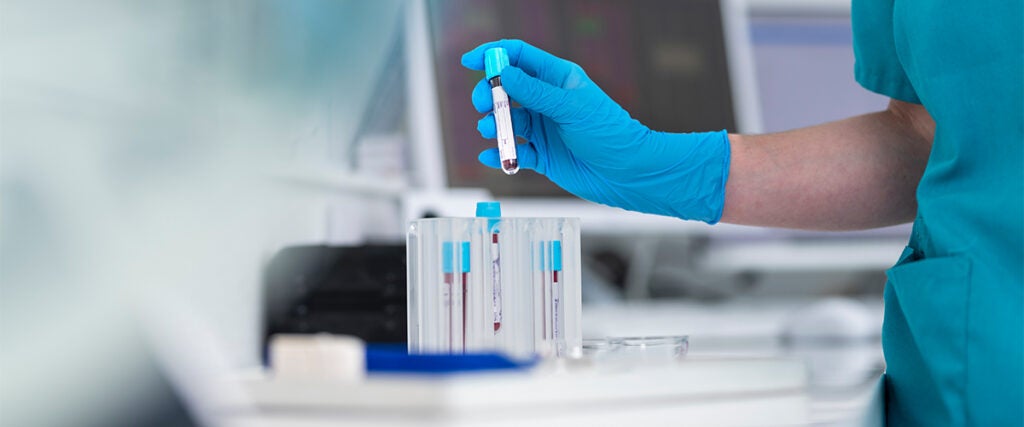 Endeavor Health brings lab into an integrated supply chain