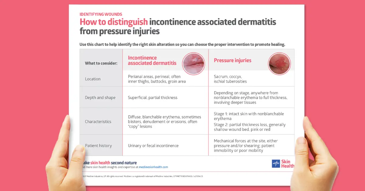How to distinguish IAD from pressure injuries - Medline