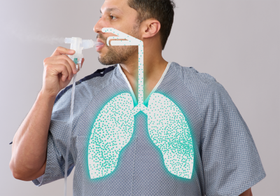 5 reasons to use high-efficiency vs standard SVN nebulizers